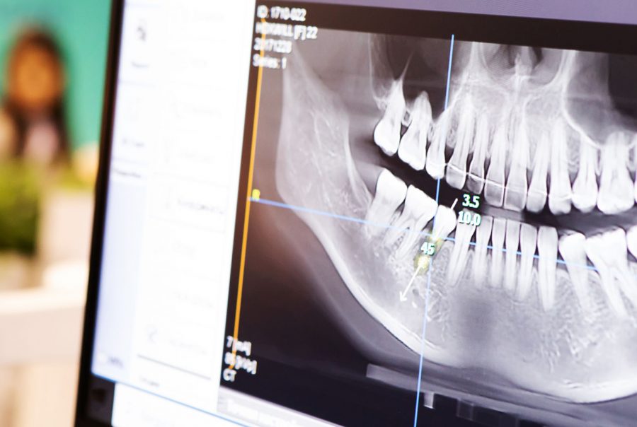 Root Canal Dental Referral Centre – Endodontist in Richmond London